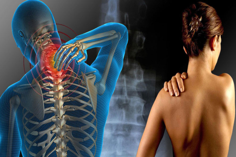 Los Dolores de columna son causantes de la deserción laboral | Trujillo ...